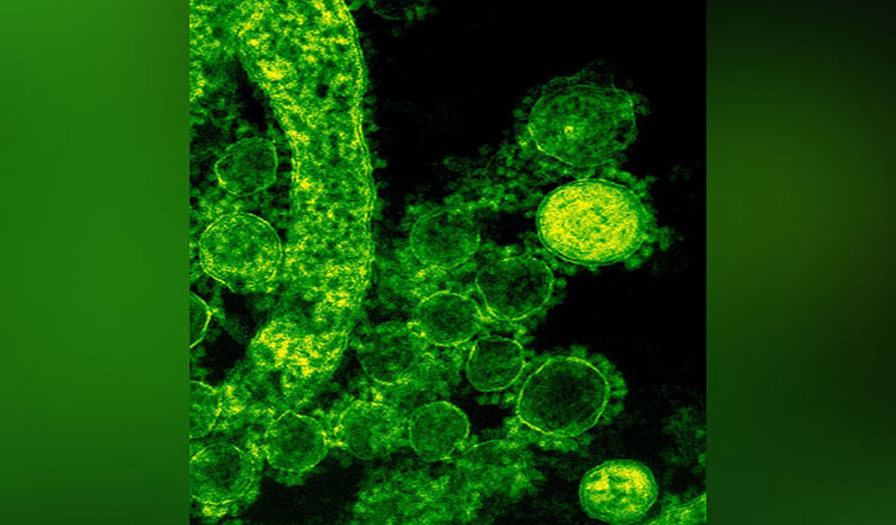 Nipah scare: Karnataka issues advisory for districts bordering Kerala ... Nipah scare: Karnataka issues advisory for districts bordering Kerala ...